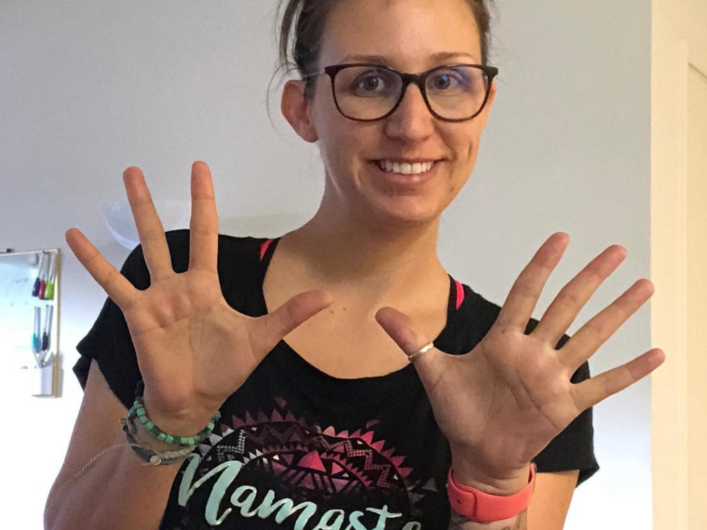 Unbelievable People With Unusual Body Parts – Page 2 – Obsev