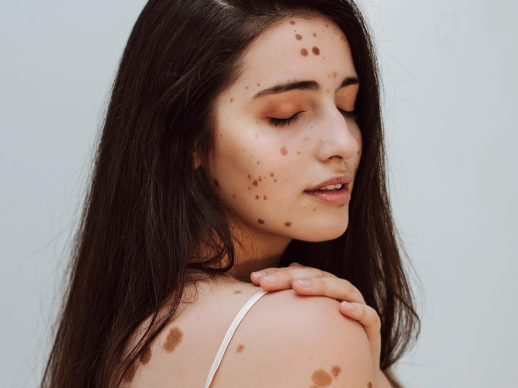 Unbelievable People With Unusual Body Parts – Page 19 – Obsev