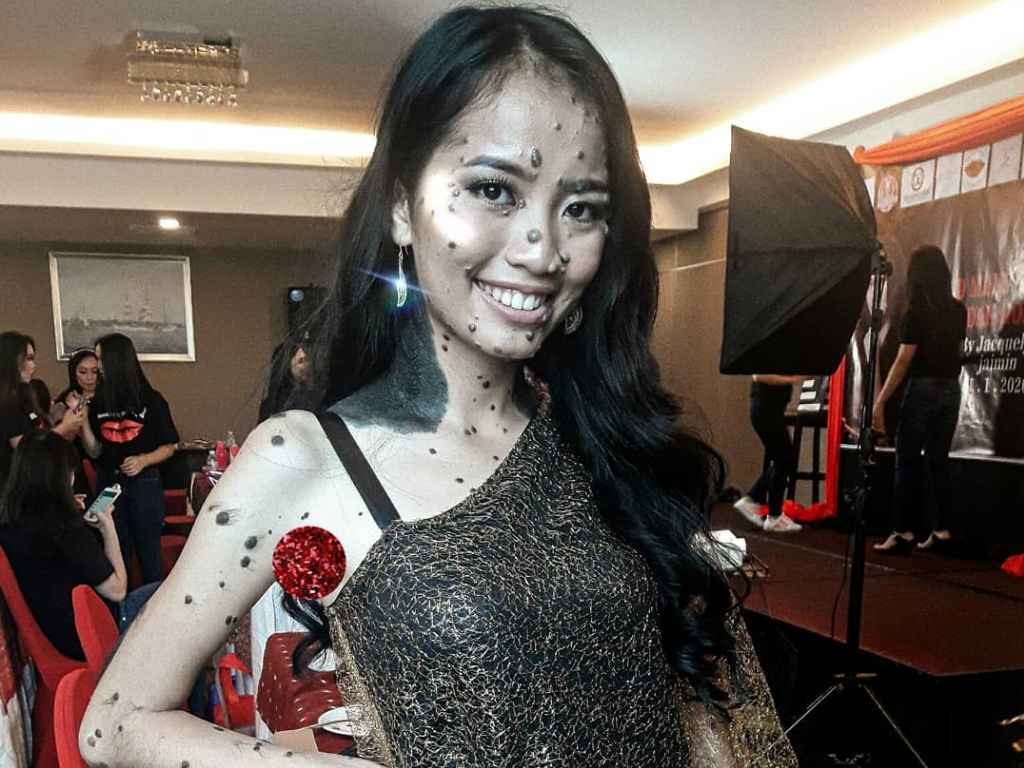 Unbelievable People With Unusual Body Parts – Page 25 – Obsev