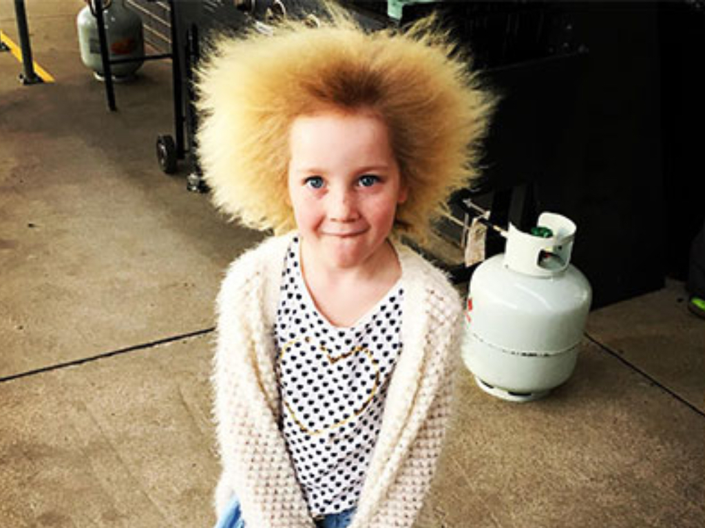 Unbelievable People With Unusual Body Parts – Page 5 – Obsev